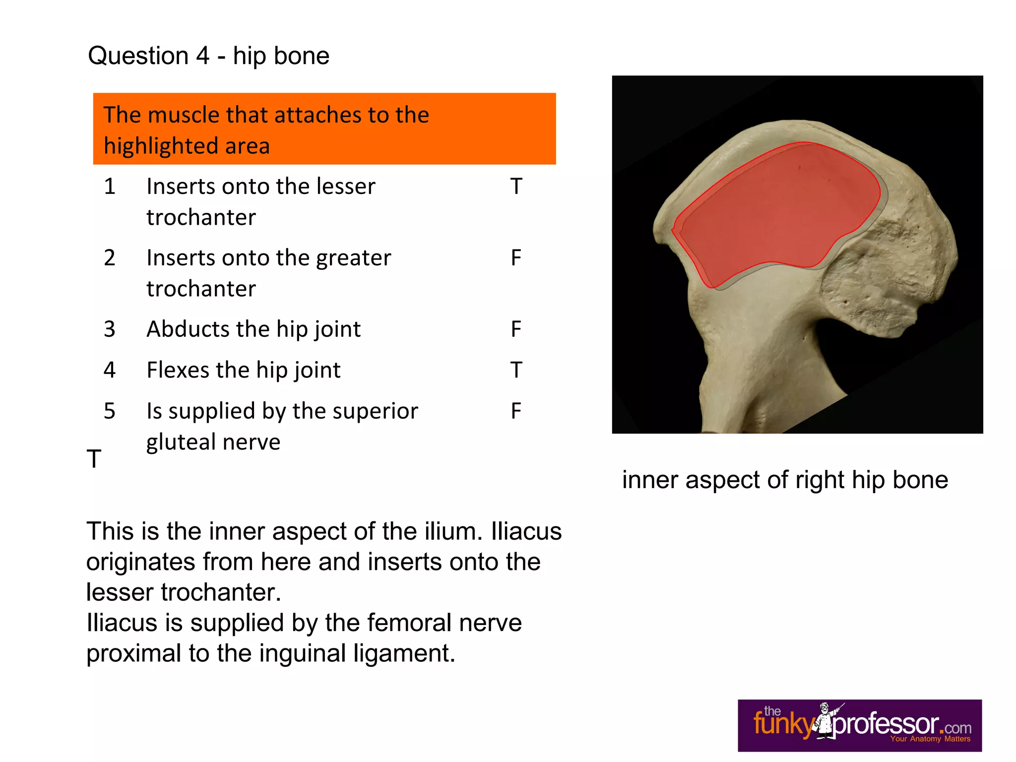 Exam Questions Hip Bone | PPT