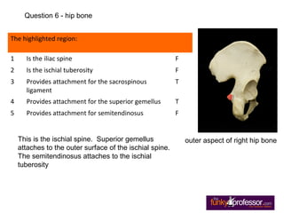 Exam Questions Hip Bone | PPT