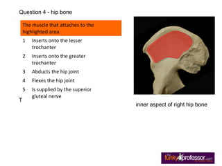 Exam Questions Hip Bone | PPT