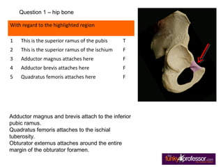 Hip Bone Anatomy Quiz