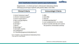 Systemic lupus erythematosus (SLE) | PPTX