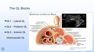 Quadratus Lumborum Block - Dr. V Koyyalamudi | PPTX