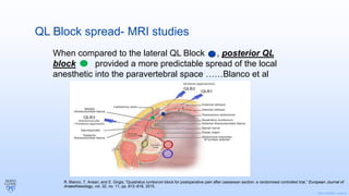 Quadratus Lumborum Block - Dr. V Koyyalamudi | PPTX