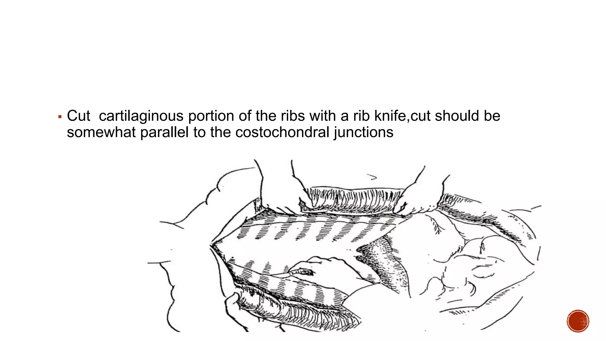 Introduction_and_principles_of autopsy | PPTX