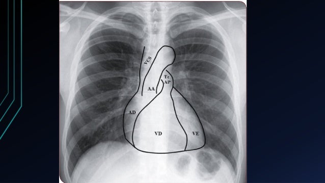 Semiologia cardíaca