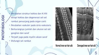 Quality of Life Presbikusis patient pptx | PPT