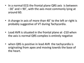 QRS axis change during ventricualr tachycardia (VT) | PPT