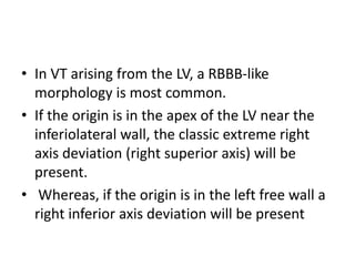 QRS axis change during ventricualr tachycardia (VT) | PPT
