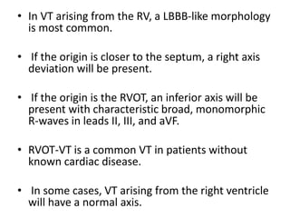 QRS axis change during ventricualr tachycardia (VT) | PPT