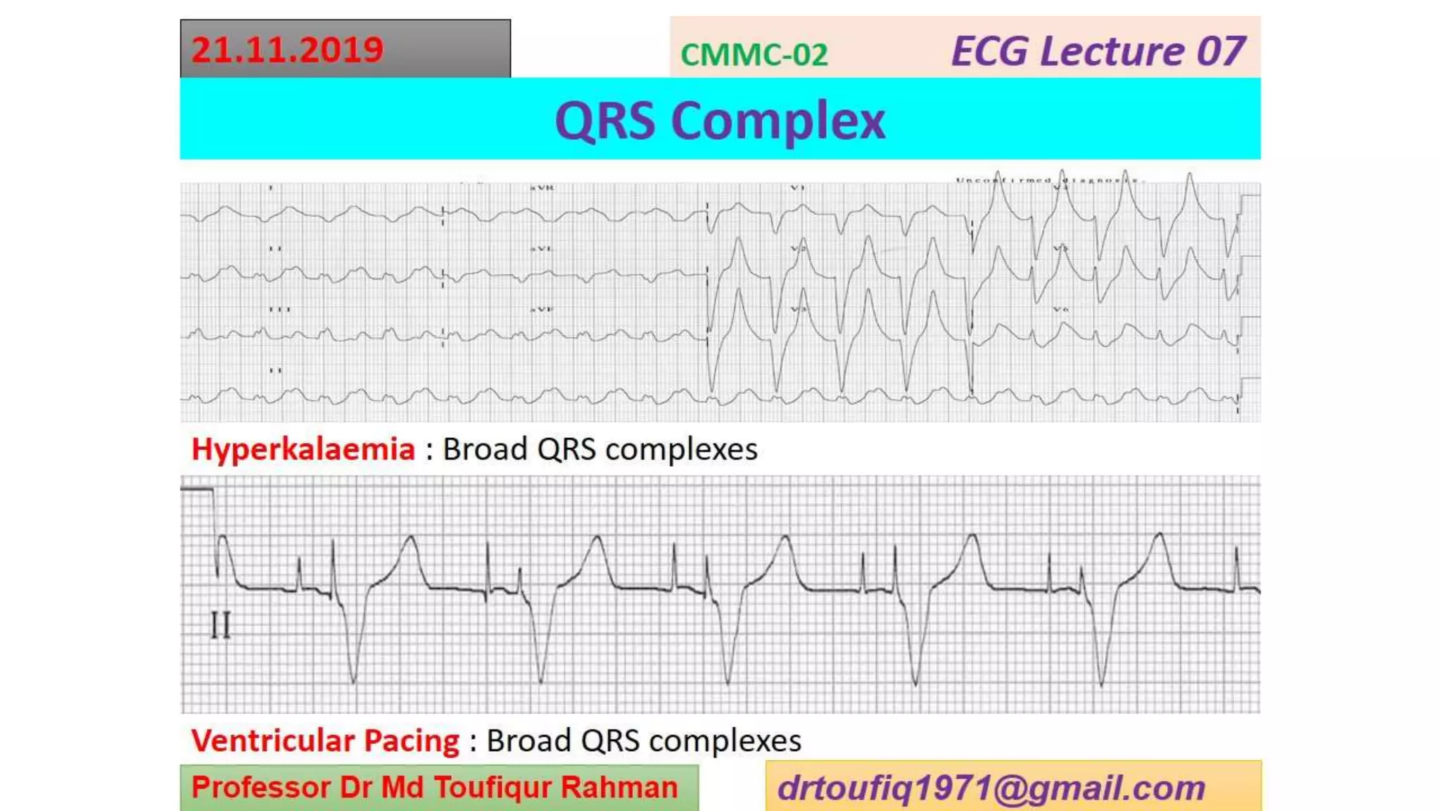 ECG -QRS complex | PPTX
