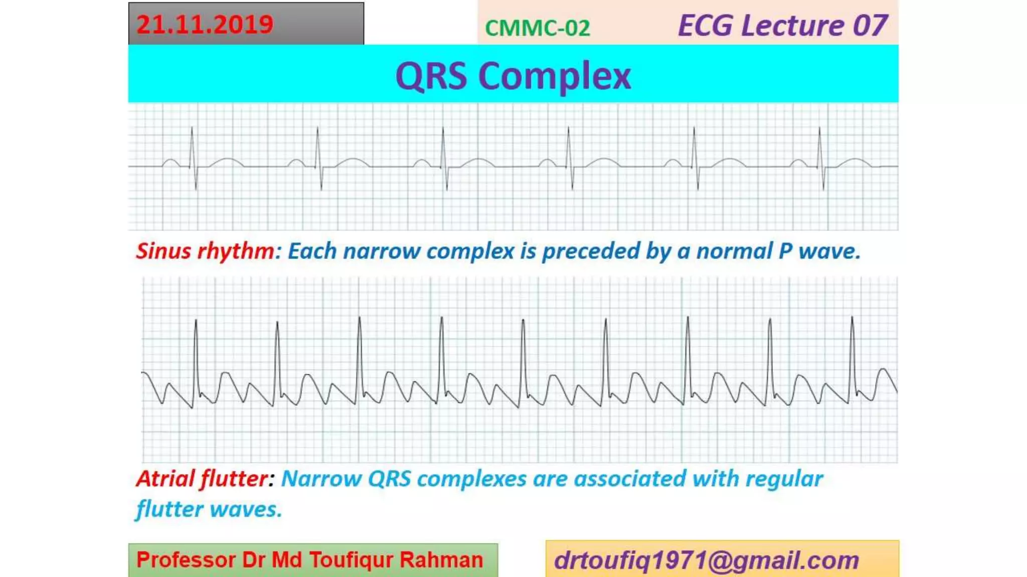 ECG -QRS complex | PPTX