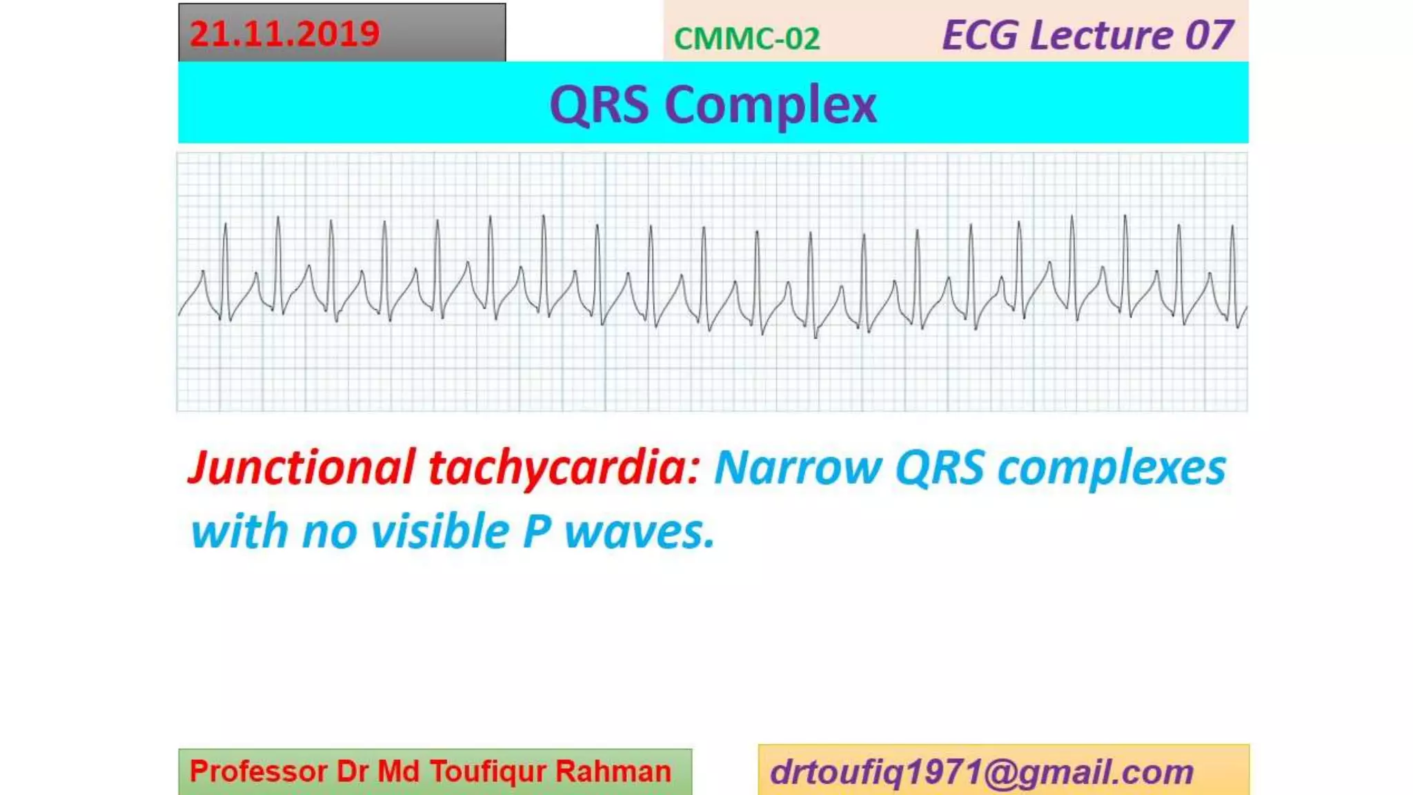ECG -QRS complex | PPTX