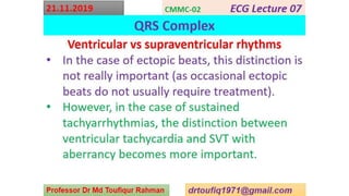 ECG -QRS complex | PPTX