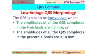 ECG -QRS complex | PPTX