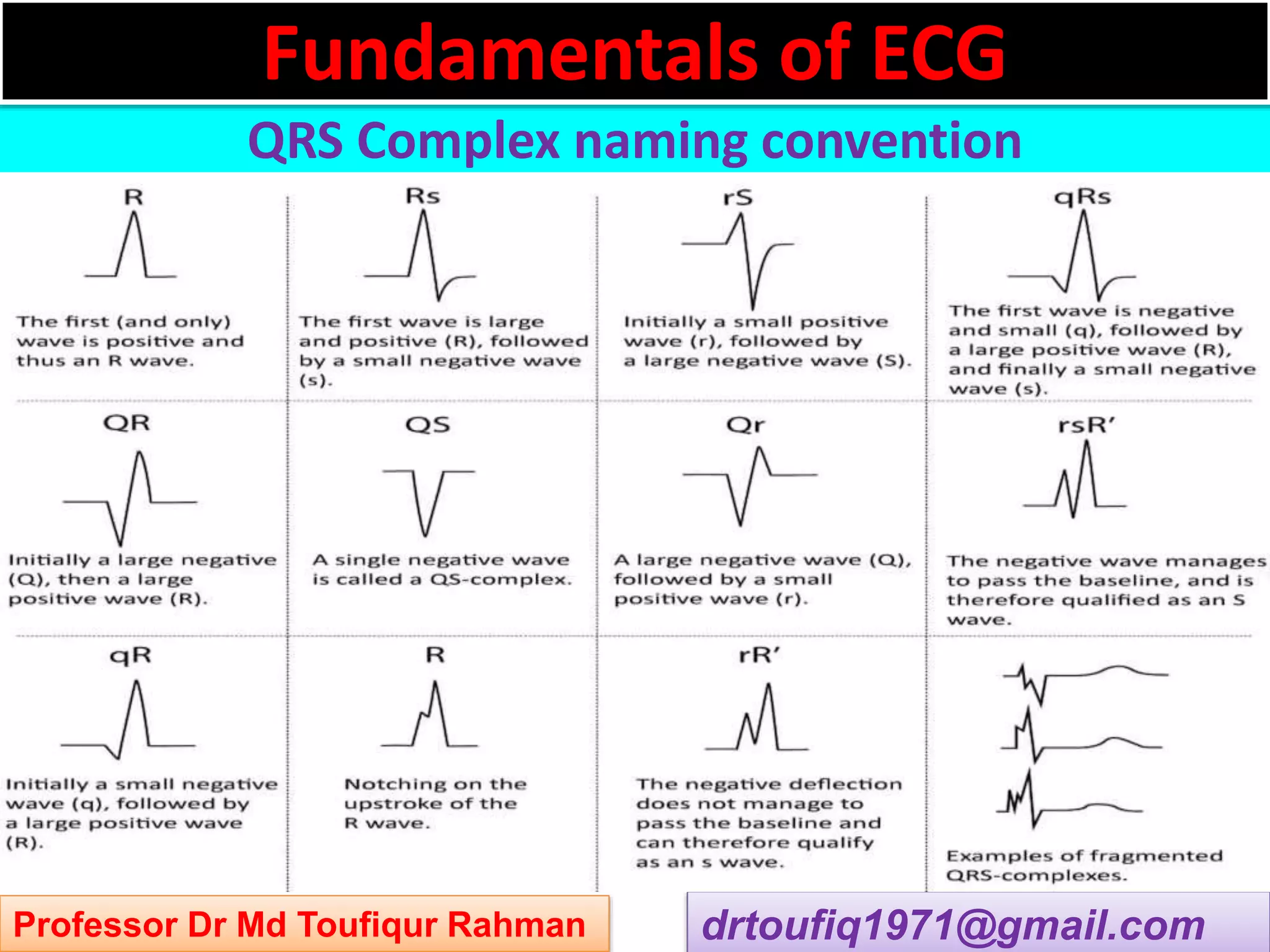 Approach To A Patient With Qrs Complex Abnormality In Ecg Ppt