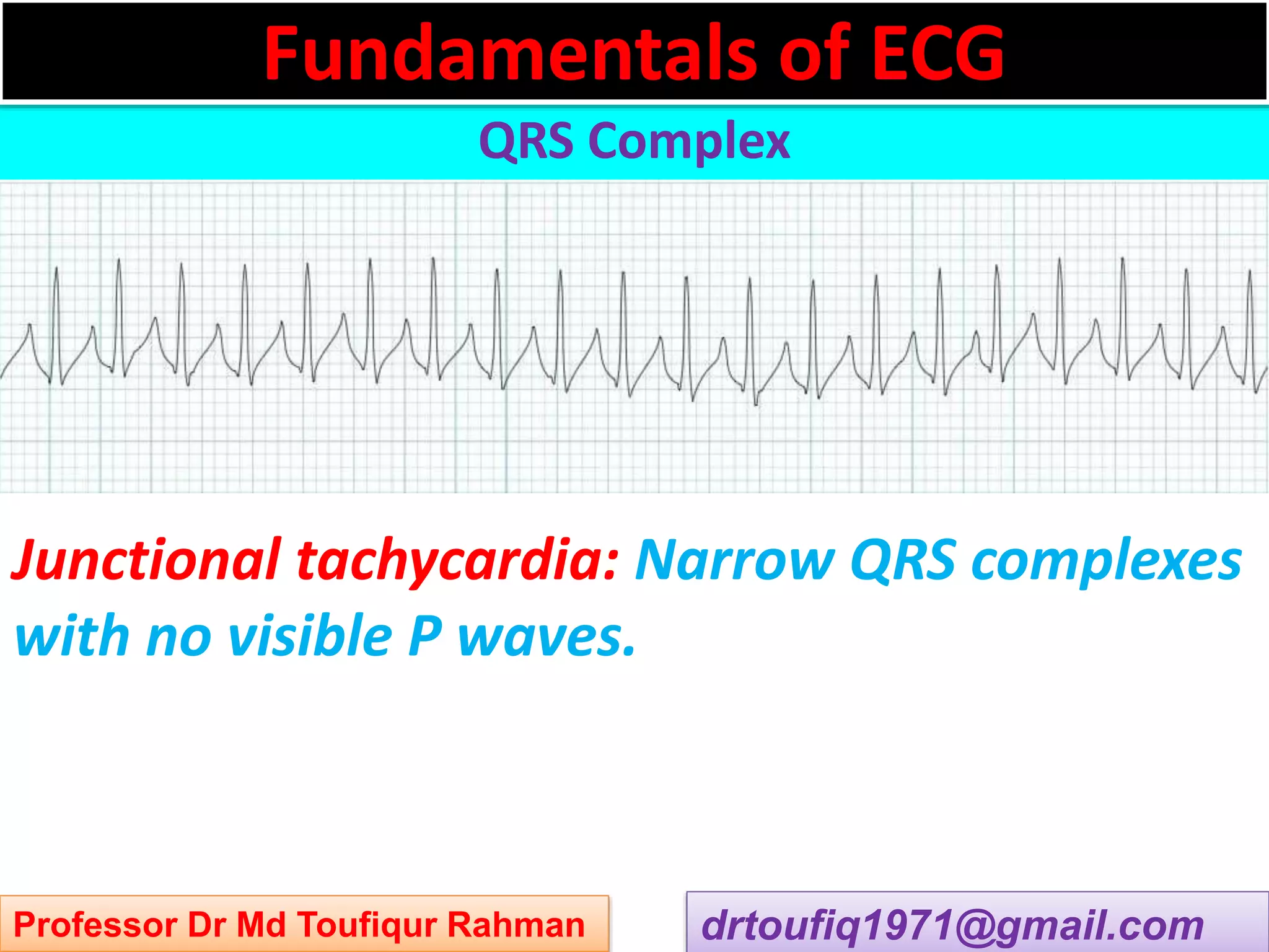 Approach to a patient with QRS complex abnormality in ECG | PPT