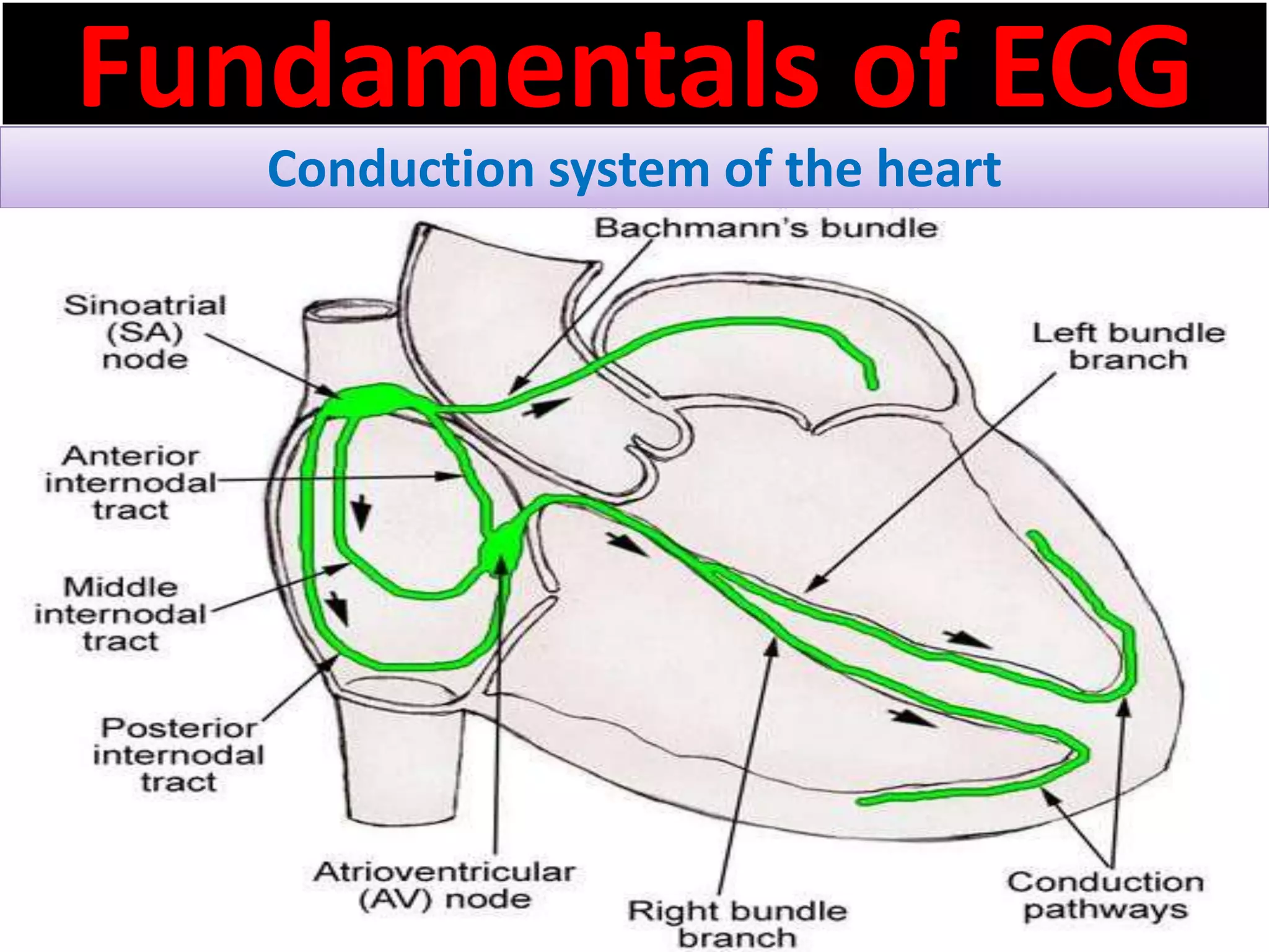 Approach To A Patient With Qrs Complex Abnormality In Ecg Ppt