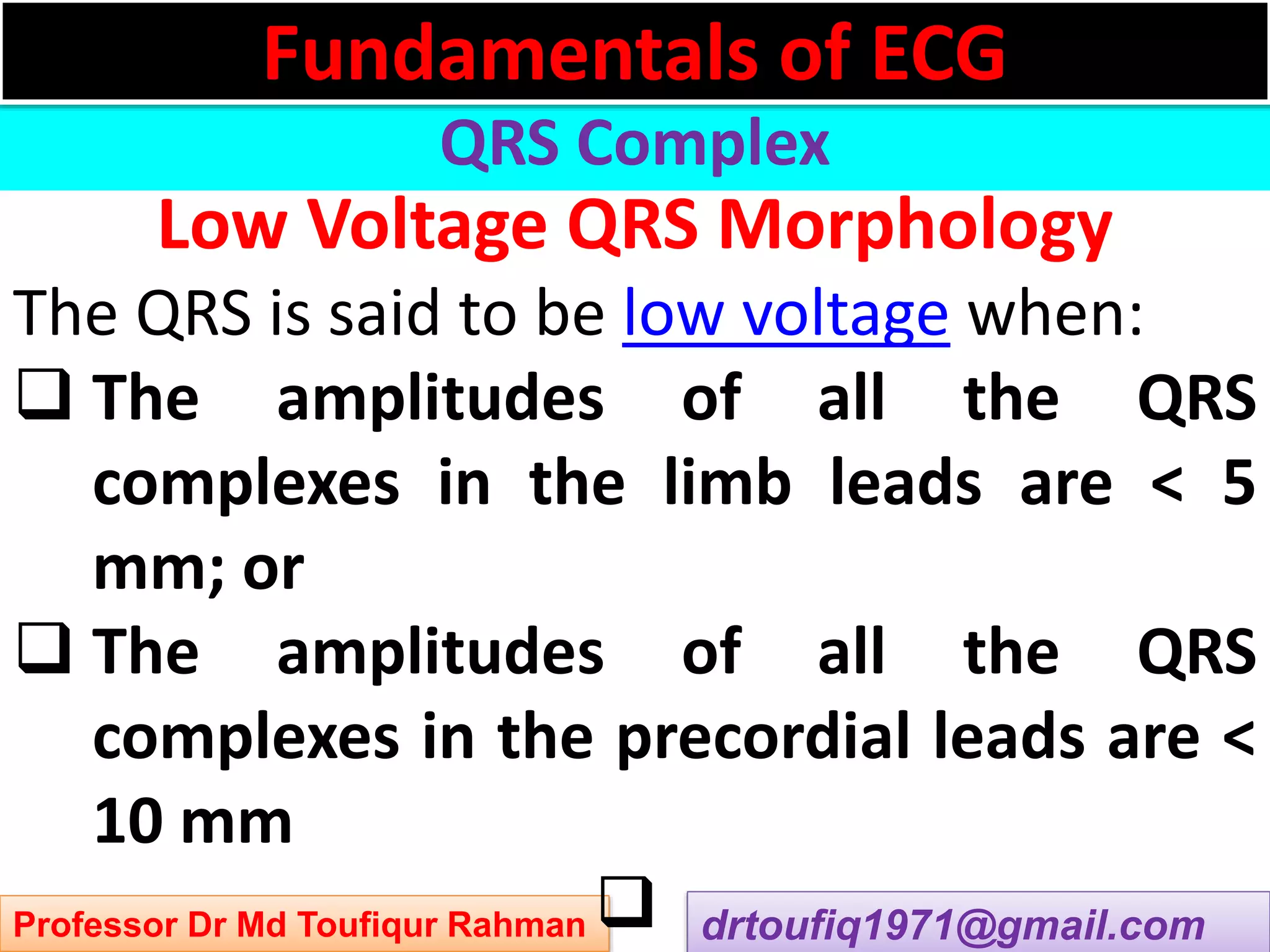 Approach to a patient with QRS complex abnormality in ECG | PPT