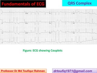 Approach to a patient with QRS complex abnormality in ECG | PPT