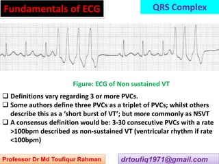 Approach to a patient with QRS complex abnormality in ECG | PPT