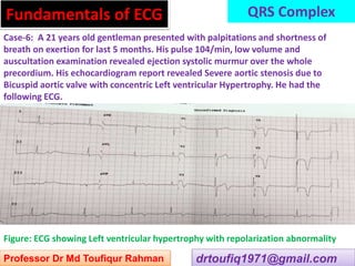 Approach to a patient with QRS complex abnormality in ECG | PPSX