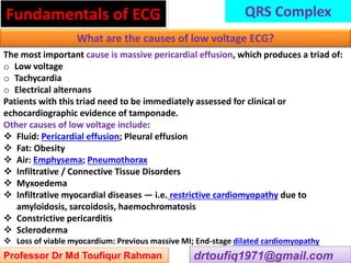 Approach to a patient with QRS complex abnormality in ECG | PPT