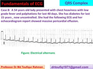 Approach to a patient with QRS complex abnormality in ECG | PPT