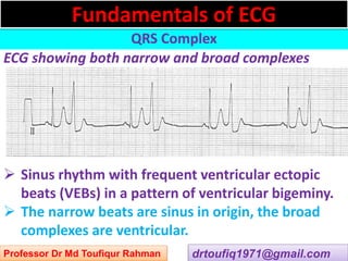 Approach to a patient with QRS complex abnormality in ECG | PPT