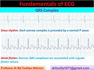 Approach to a patient with QRS complex abnormality in ECG | PPT