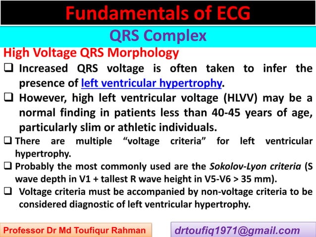 Approach To A Patient With Qrs Complex Abnormality In Ecg Ppt