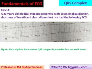 Approach to a patient with QRS complex abnormality in ECG | PPT