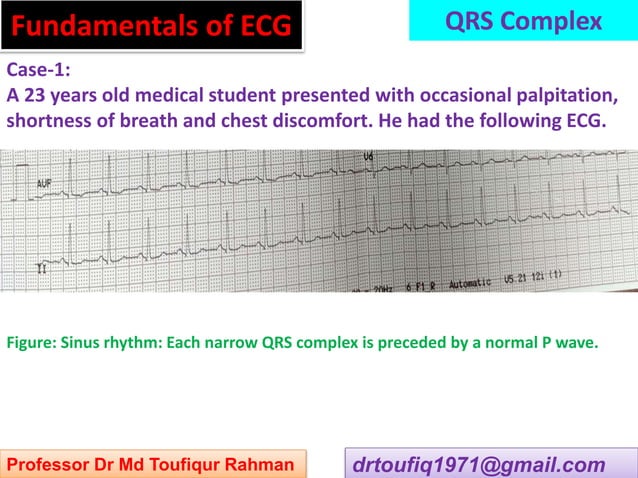Approach to a patient with QRS complex abnormality in ECG | PPT