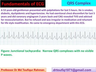 Approach to a patient with QRS complex abnormality in ECG | PPT