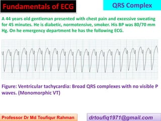 Approach to a patient with QRS complex abnormality in ECG | PPT