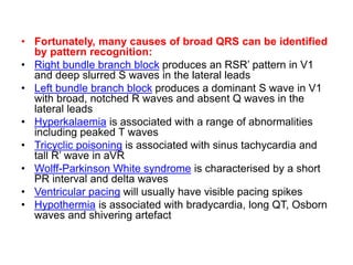 QRS INTERVAL IN ECG AND ITS ABNORMALITIES | PPTX