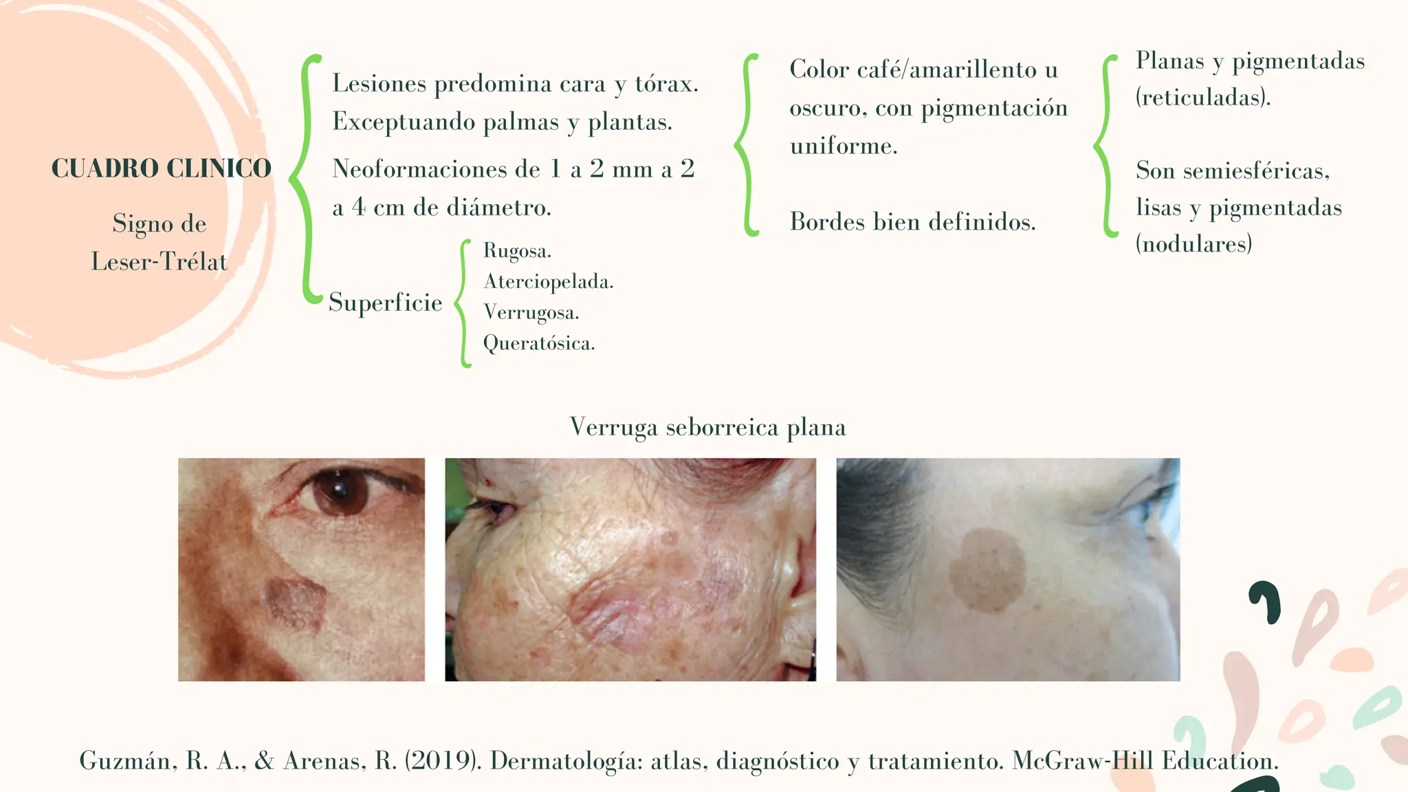 Queratosis seborrica en dermatología y piel | PDF