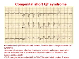 QT INTERVAL IN ECG,CAUSES OF SHORT AND LONG QT INTERVAL | PPT