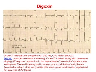 QT INTERVAL IN ECG,CAUSES OF SHORT AND LONG QT INTERVAL | PPTX