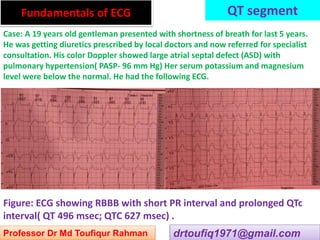 Approach to a patient with QTc interval abnormality in ECG | PPSX