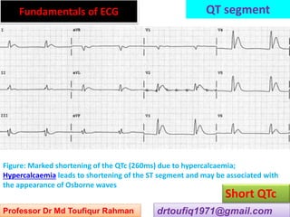 Approach to a patient with QTc interval abnormality in ECG | PPSX