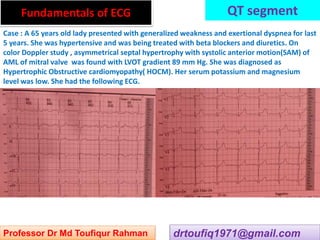Approach to a patient with QTc interval abnormality in ECG | PPSX
