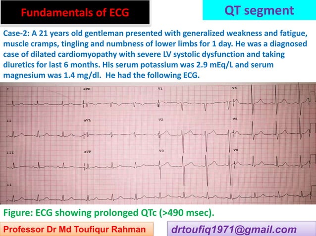Approach to a patient with QTc interval abnormality in ECG | PPSX