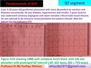 Approach to a patient with QTc interval abnormality in ECG | PPSX