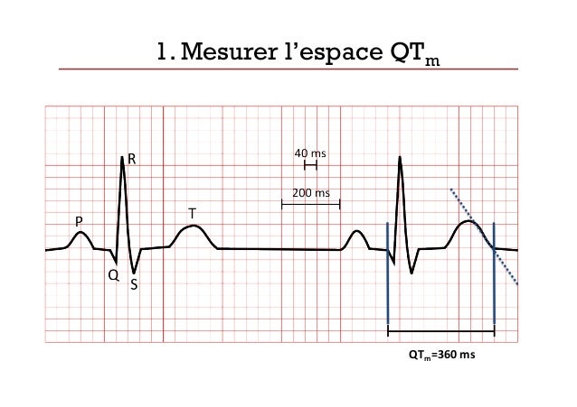 Conduite à tenir devant un QT long - Dr Stéphane Boulé - Lille