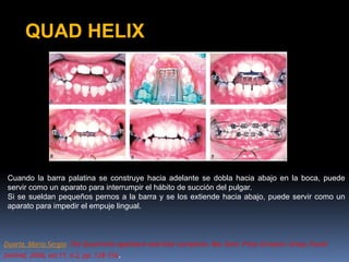 quad helix, caracteristicas, expansiones | PPTX