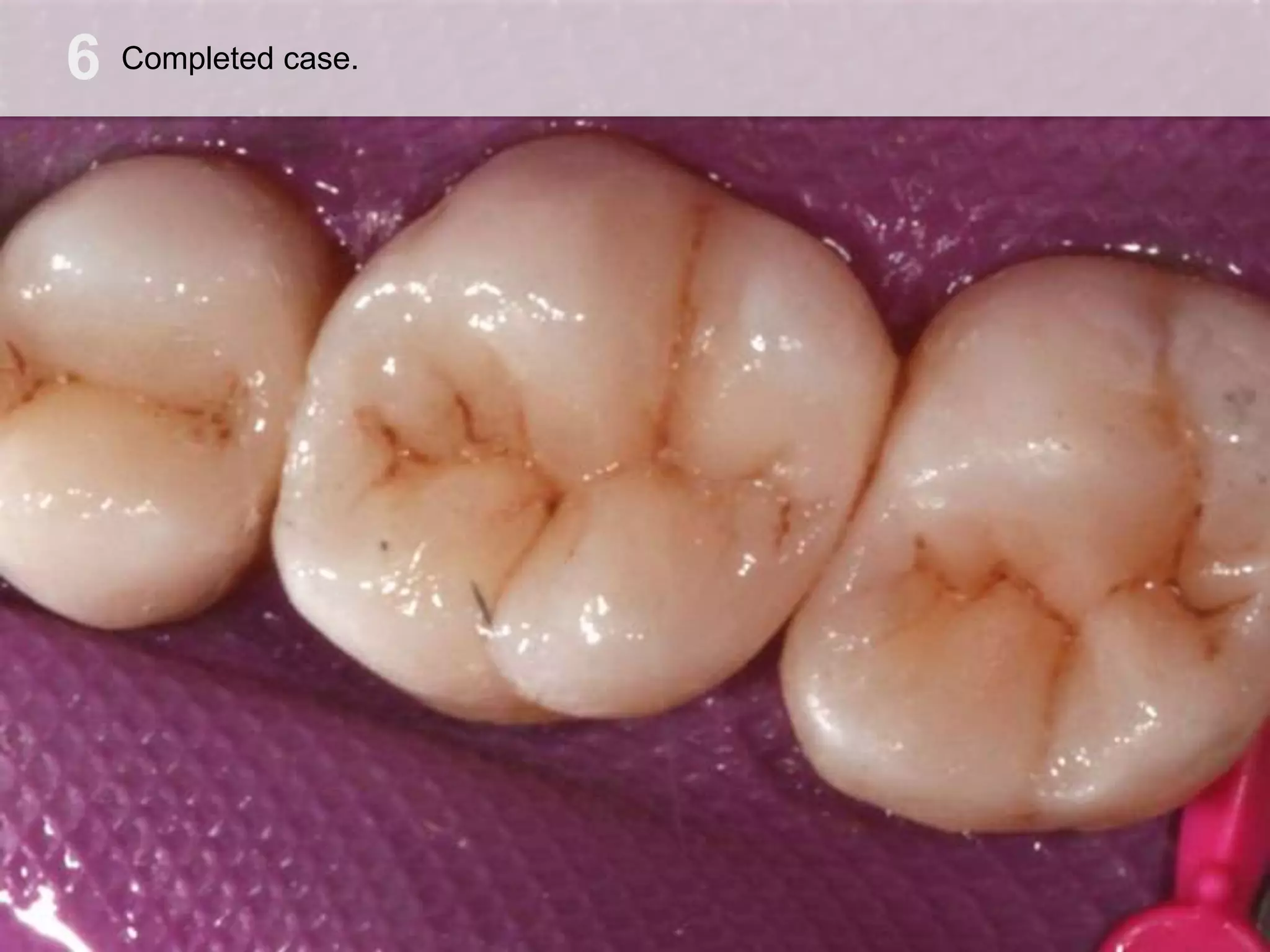 Quadrant Dentistry by Dr Jason Smithson | PPTX