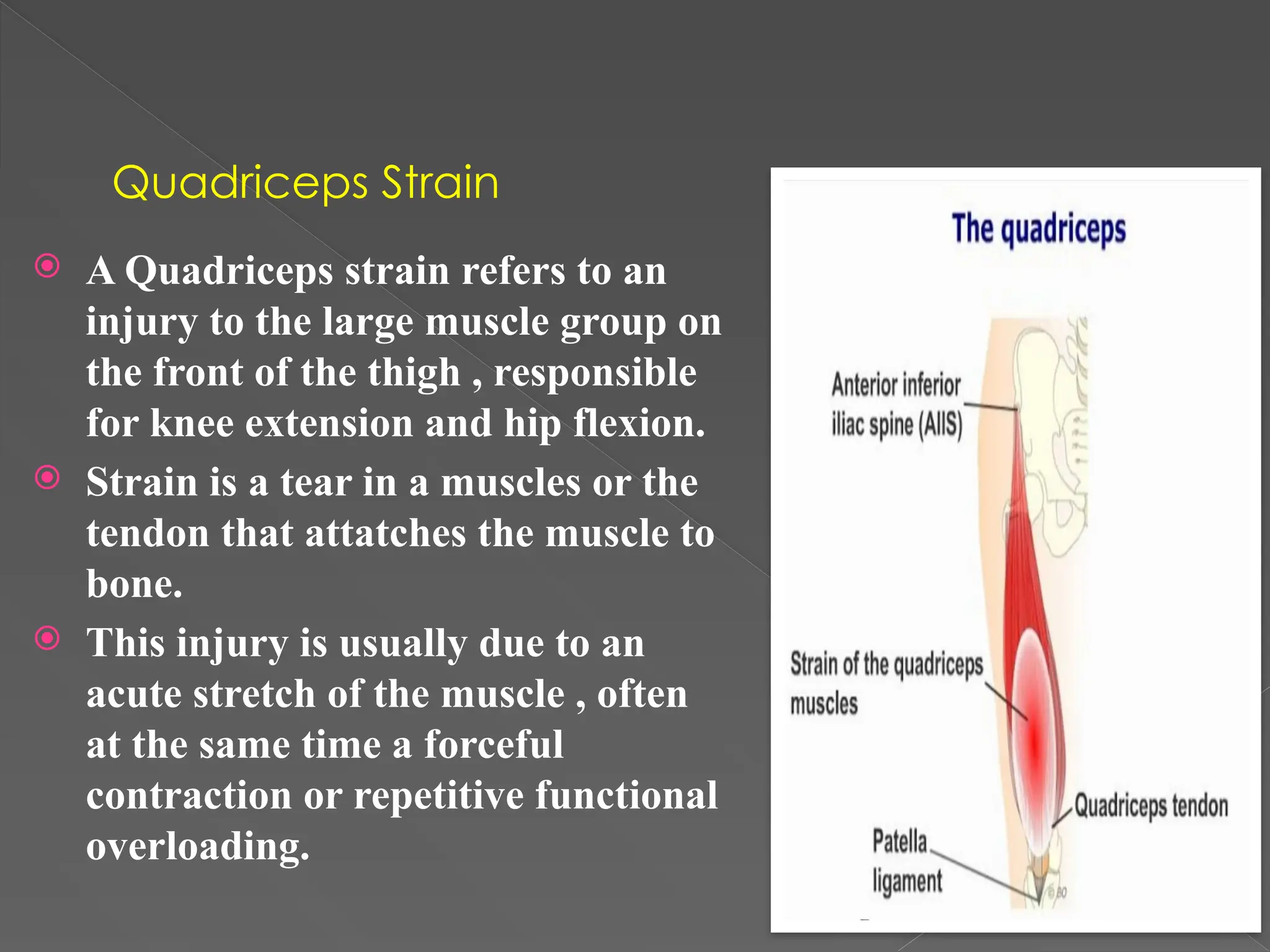 Quadriceps Strain And Physiotherapy Management.pptx