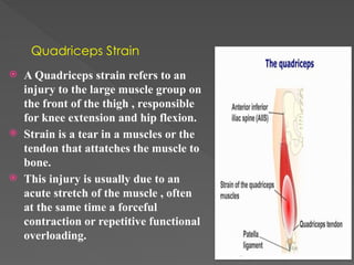 Quadriceps Strain And Physiotherapy Management.pptx