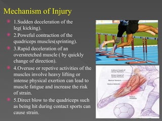 Quadriceps Strain And Physiotherapy Management.pptx