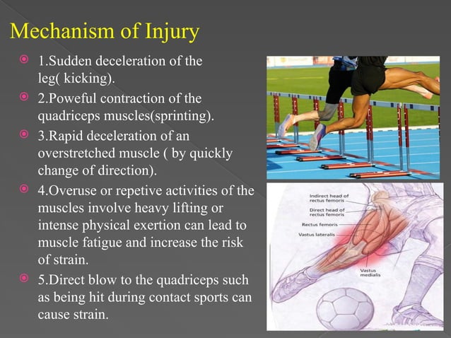 Quadriceps Strain And Physiotherapy Management.pptx | Death, Injury, or ...